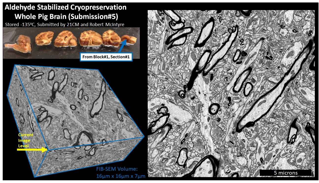 Aldehyde Stabilized Cryopreserved Pig Brain Evaluation Images – The ... Aldehyde Stabilized Cryopreserved Pig Brain Evaluation Images – The ...